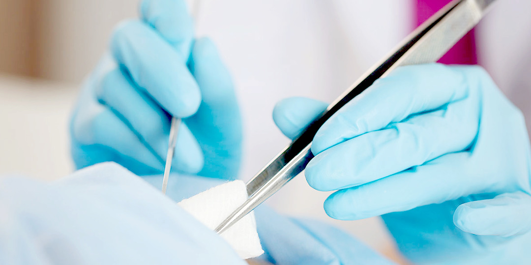 Buat Janji Tindakan Medis, Prosedur Medis, Perawatan Medis Ekstraksi ...