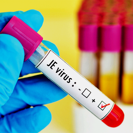 Buat Janji Tindakan Medis, Prosedur Medis, Perawatan Medis Vaksin Imojev.