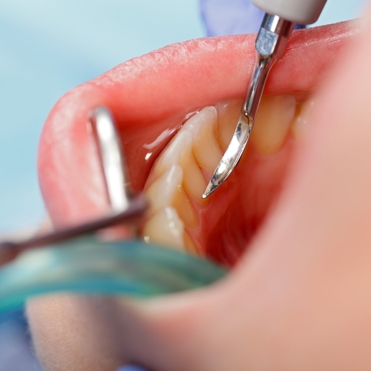 Buat Janji Tindakan Medis, Prosedur Medis, Perawatan Medis Scaling ...