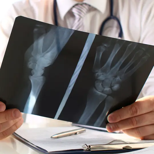 Buat Janji Tindakan Medis, Prosedur Medis, Perawatan Medis Rontgen Bahu.