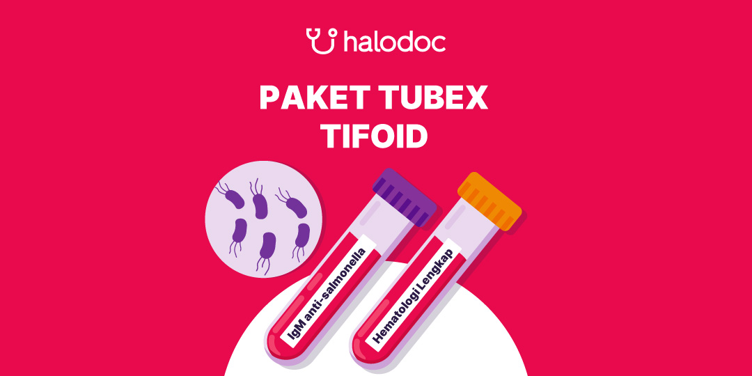 Buat Janji Tindakan Medis, Prosedur Medis, Perawatan Medis Paket Tubex ...